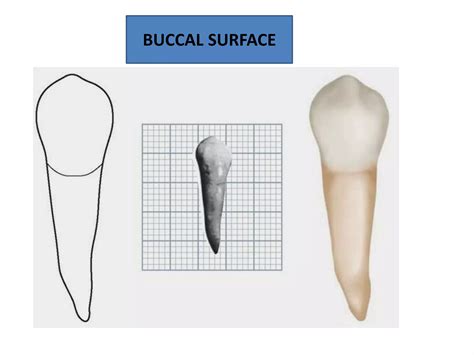 Permanent Mandibular First Premolar Pptx Dental Health Diseases