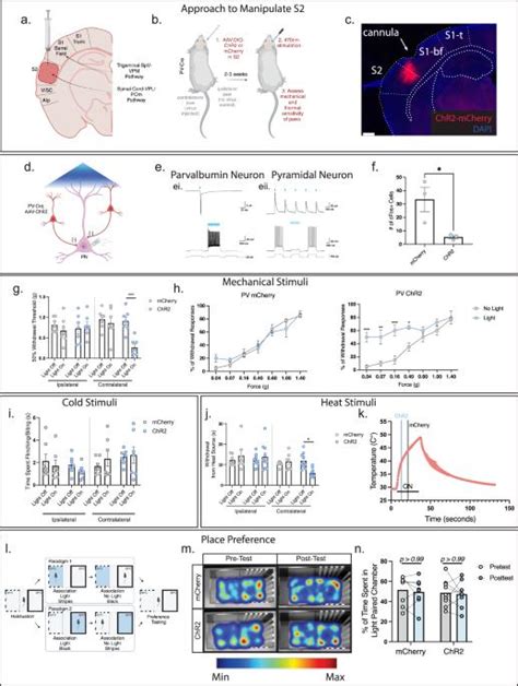 Mark Taub On Linkedin The Secondary Somatosensory Cortex Gates