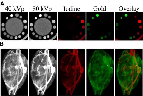 Dual Energy Micro Ct Material Decomposition A In Vitro Phantom