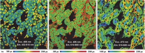 9 Flim With Excitation Wavelength Multiplexing 405 Nm And 473 Nm