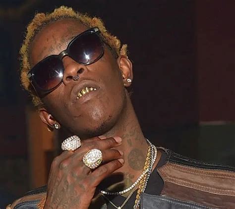 Young Thug Teeth Oldnew Before And Afters Lema