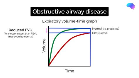 Spirometry Interpretation Obstructive Vs Restrictive Geeky Medics
