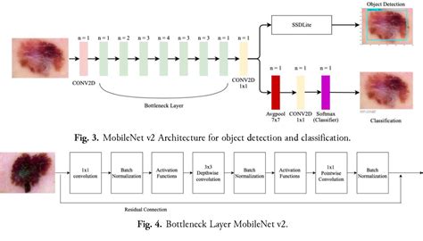 Figure 1 From Android Skin Cancer Detection And Classification Based On
