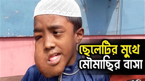 মাদ্রাসার ছাত্র এই ছেলেটির মুখে মৌমাছির বাসা Youtube