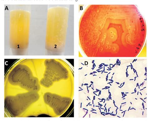 Figure 1 From Molecular Detection Of Clostridium Perfringens Toxinotypes Enteropathogenic