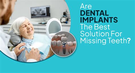 Are Dental Implants The Best Solution For Missing Teeth