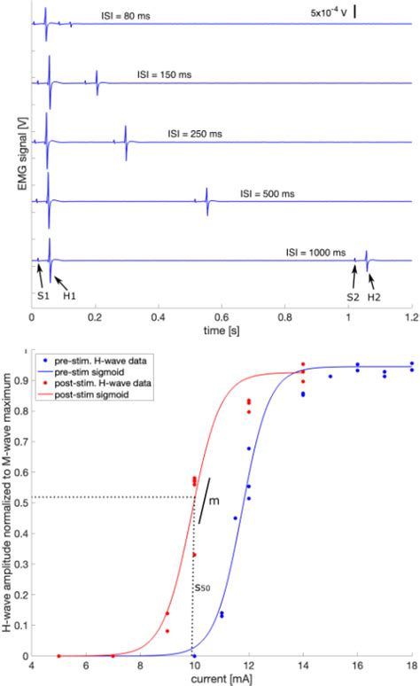 Figure 3 From The Effect Of Transcutaneous Spinal Cord Stimulation On
