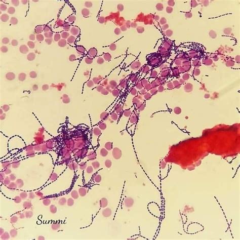 Microbiologia 🦠streptococcus Mitis 🔴el Streptococcus Mitis Es Una