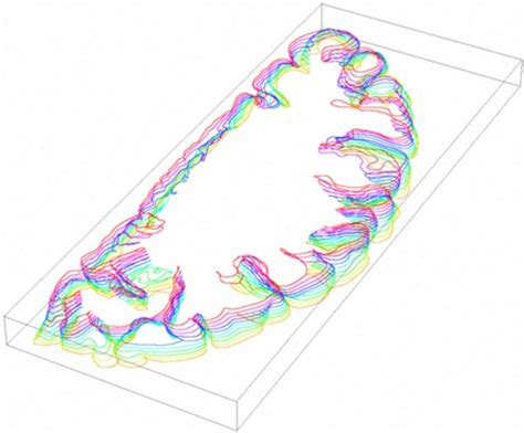 Determination Of Cortical Contours A Segmented Cortical Surface Of