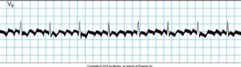 Abnormalities Flashcards Quizlet