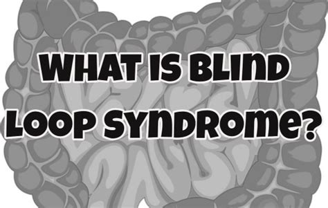 Gastroenterologists In Florida What Is Blind Loop Syndrome Gastroenterologists In Florida
