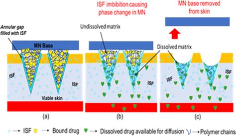 Modeling Of Dissolving Microneedle Based Transdermal Drug Delivery