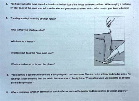 SOLVED 3 The Diagram Depicts Testing Of Which Reflex What Is This Type Of Reflex Called Which