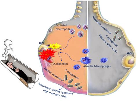 Figure 1 From Impact Of Lung Microbiota On Copd Semantic Scholar