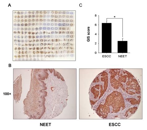 Tissue Microarray Analysis Of Galectin 7 Expression A Overview Of Download Scientific