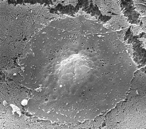 Scanning Electron Microscopy Sem Image Of A Critical Pointdried Liver