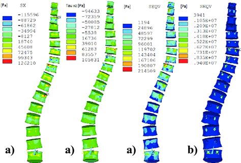 Stresses In A A Cancellous Bone B Cortical Bone Download Scientific Diagram
