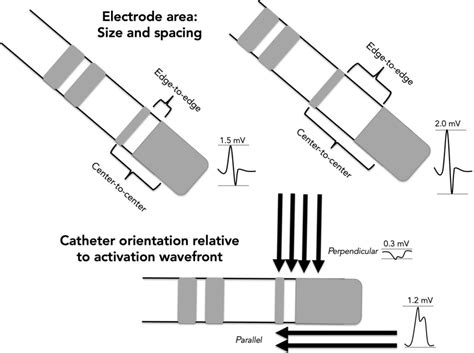 determinants of bipolar amplitude electrode area and catheter