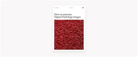 How To Annotate Digital Pathology Images For AI