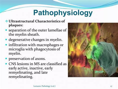 Multiple Sclerosis Adjusted To Publish Ppt
