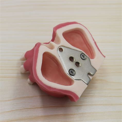 Conduction Anesthesia Model Jojenmodel Dental Model Teeth Dental