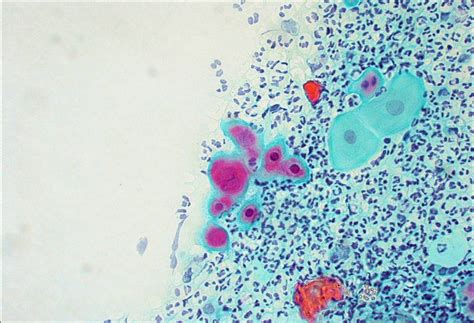 Eurocytology