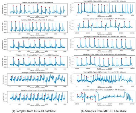Applied Sciences Free Full Text Fast And Accurate Algorithm For Ecg Authentication Using