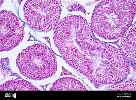 Labeled Epididymis Microscope Slide