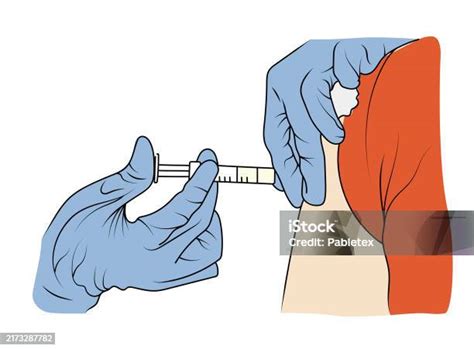 라텍스 장갑을 낀 손 팔에 주사기로 백신을 적용하는 모습 백신접종에 대한 스톡 벡터 아트 및 기타 이미지 백신접종 청년
