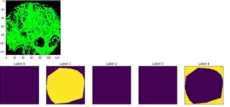 Tensorflow Image And Mask Normalization In Semantic Segmentation For Cancer Stack Overflow
