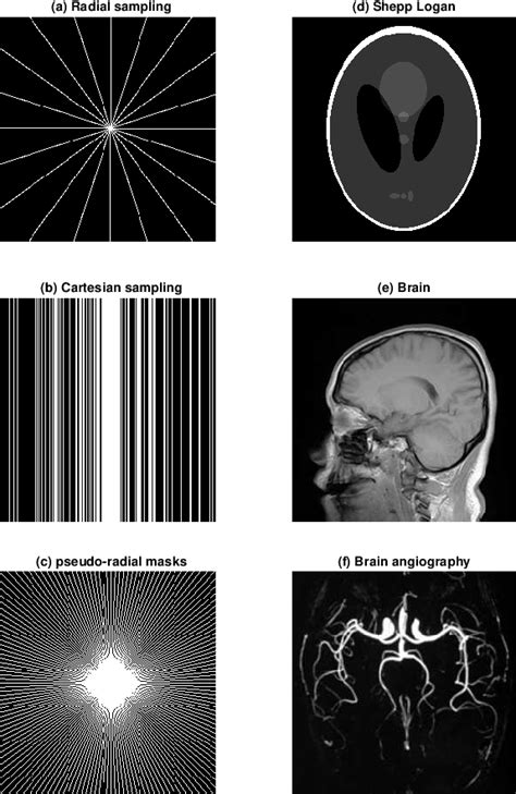 Figure From A Symmetric ADMM For Non Convex Regularization Magnetic Resonance Imaging