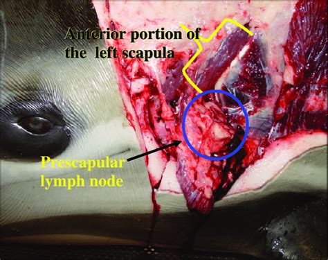 Location Of Prescapular Lymph Node In Situ Download Scientific Diagram