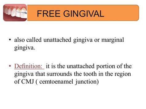 Marginal Gingiva