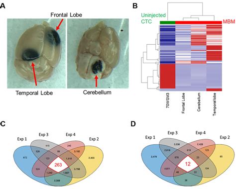 The Hierarchical Transcriptional Classification Of Ctc Driven Mbm Download Scientific Diagram