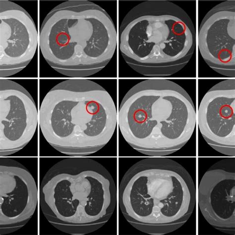 Samples From The CT GAN Dataset Where The First Row Shows The FB Download Scientific Diagram