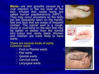 Premarital Sex Can Kill You PPT