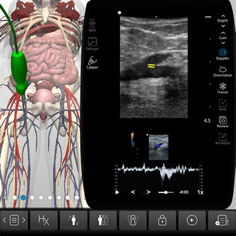 Vascular Ultrasound Training Peripheral Vascular Disease Ultrasound