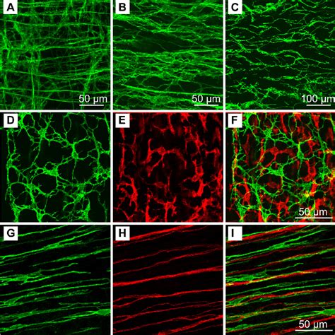 Figure 3 From Interstitial Cells Regulators Of Smooth Muscle Function