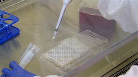 Video Evaluation Of Antimicrobial Activities Of Nanoparticles And