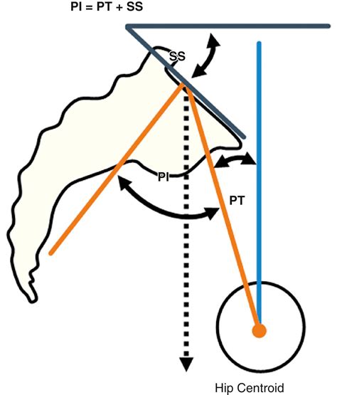 Adjacent Segment Degeneration And Disease Of The Lumbar Spine Clinical Tree