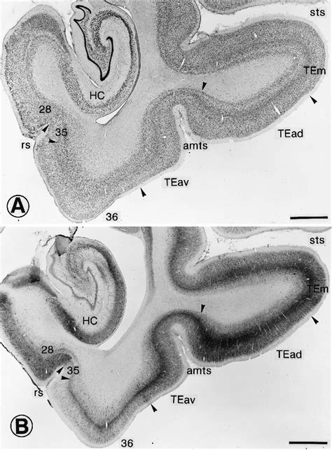 Pdf Divergent Projections From The Anterior Inferotemporal Area Te To