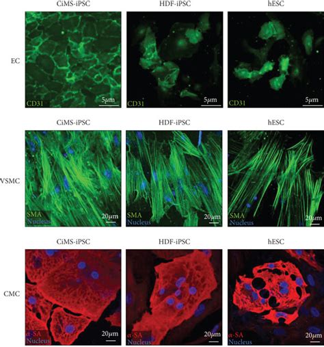 Mesoderm Differentiation Preference In The Process Of Cims Ipsc