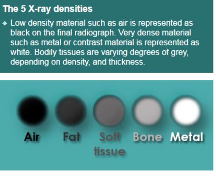 Abnormal Chest X Rays Flashcards Quizlet