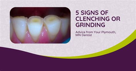 What Is Clenching Teeth A Symptom Of