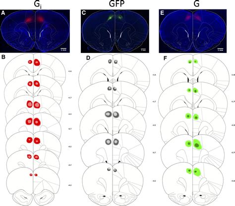 Anterior Cingulate Cortex