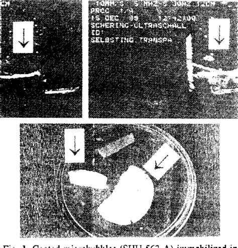 Figure 1 From Nonlinear Acoustical Response Of Coated Microbubbles In Diagnostic Ultrasound
