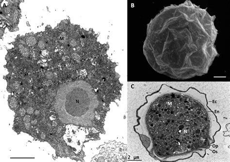Acanthamoeba Cyst Morphology