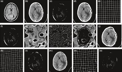 Brain Image Multimodality Registration Result A Mri Reference Image Download Scientific