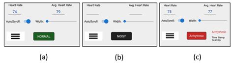 Signal Detection A Normal B Noisy C Arrhythmic Download Scientific Diagram