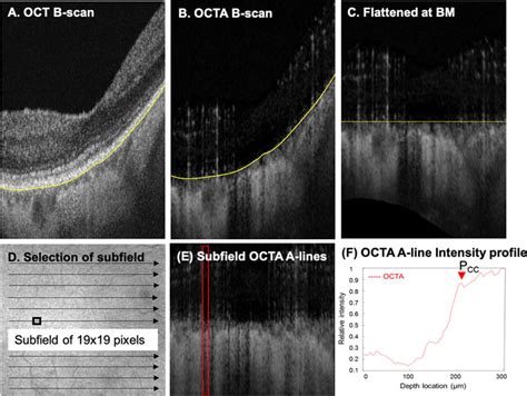 Methodology For Generating OCTA A Scan Intensity Profiles From OCT Download Scientific Diagram